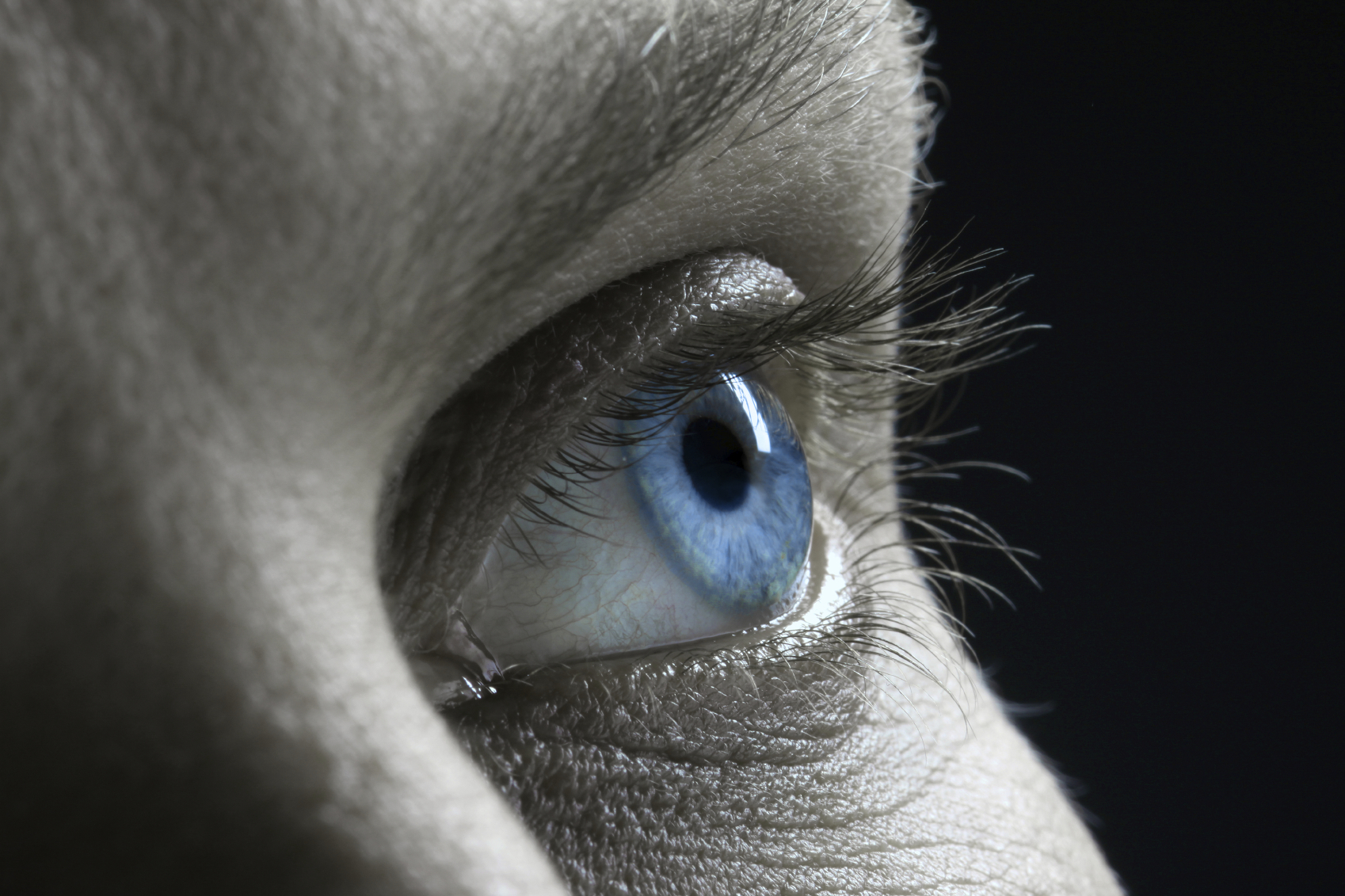 Le Syndrome du Gougerot - Sjögren (SGS) - Fondation Arthritis